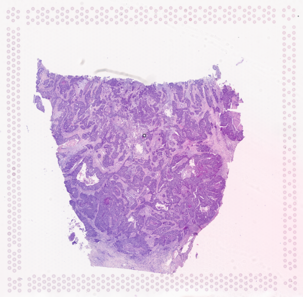 DeepSpaceDB: DSID000585