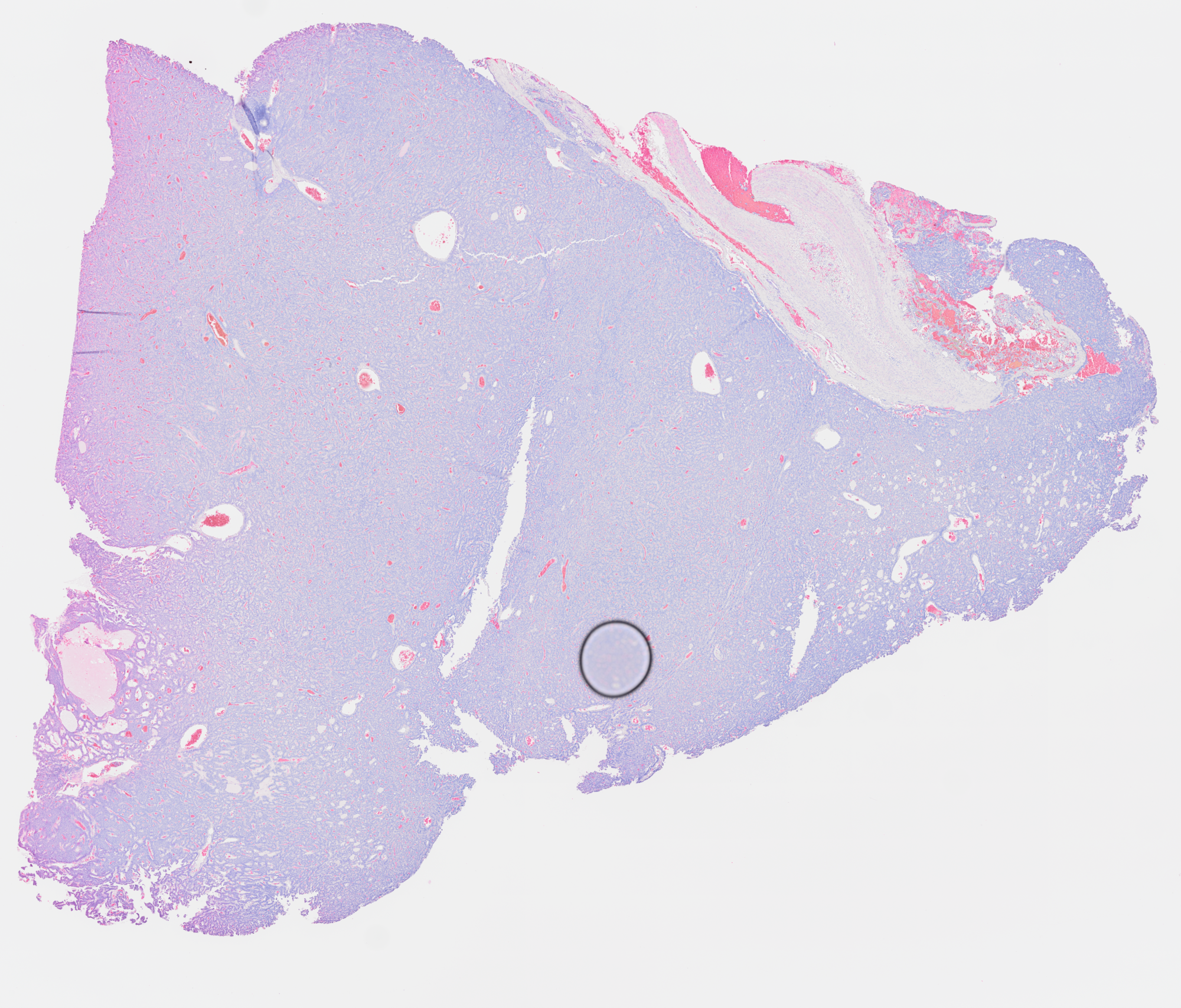 DeepSpaceDB: DSID000629