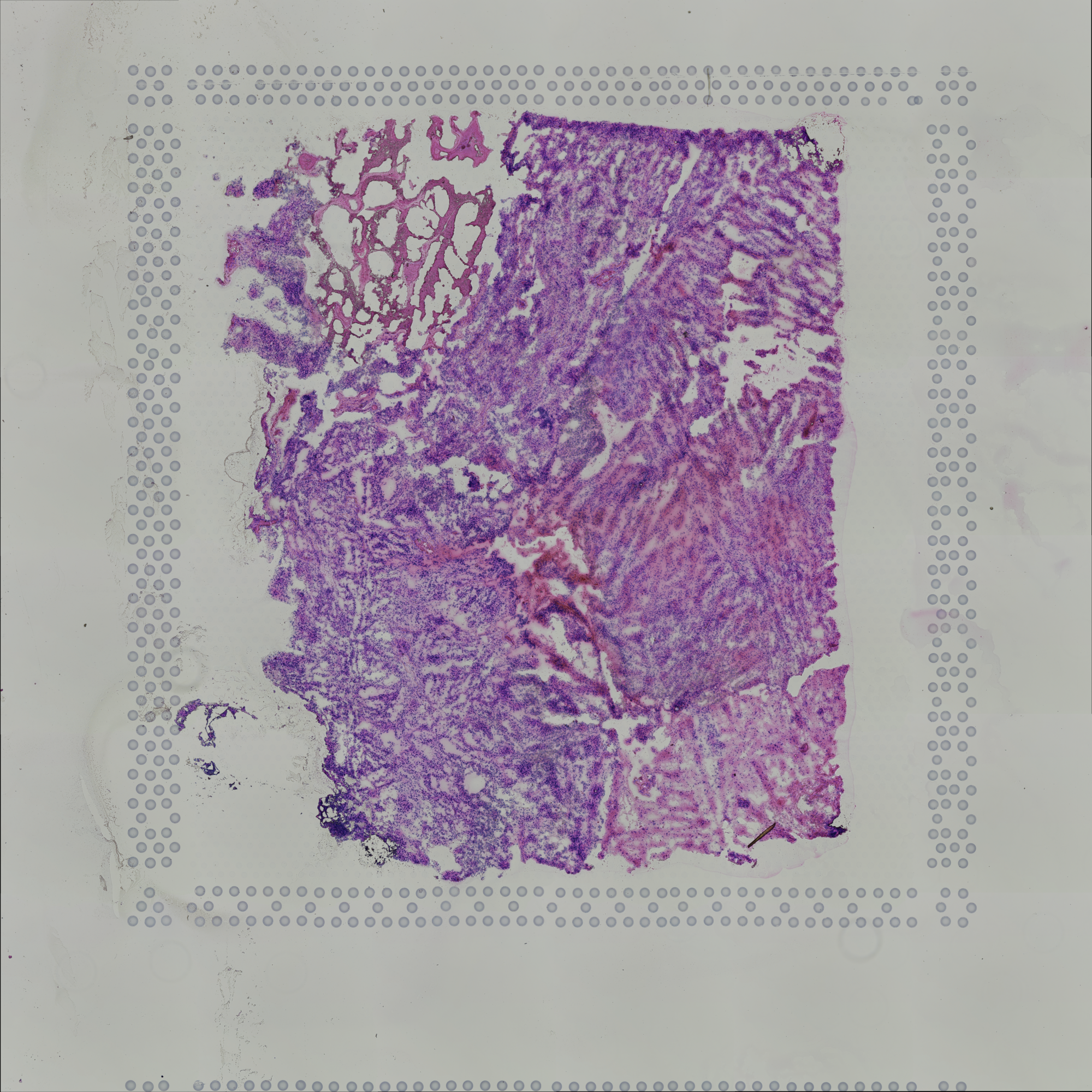 DeepSpaceDB: DSID000647